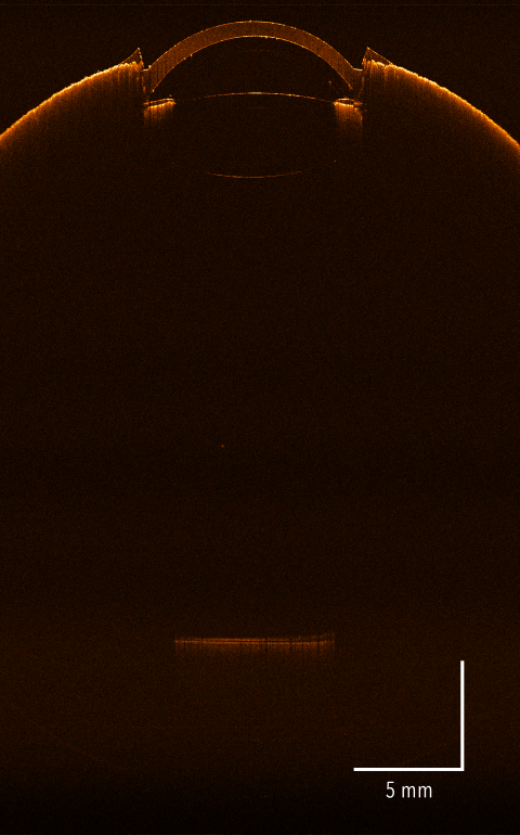 MEMS-VCSEL Swept-Wavelength Laser Sources